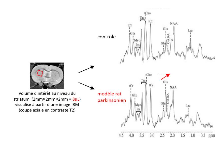 Accueil - La spectroscopie RMN du proton localisée in vivo